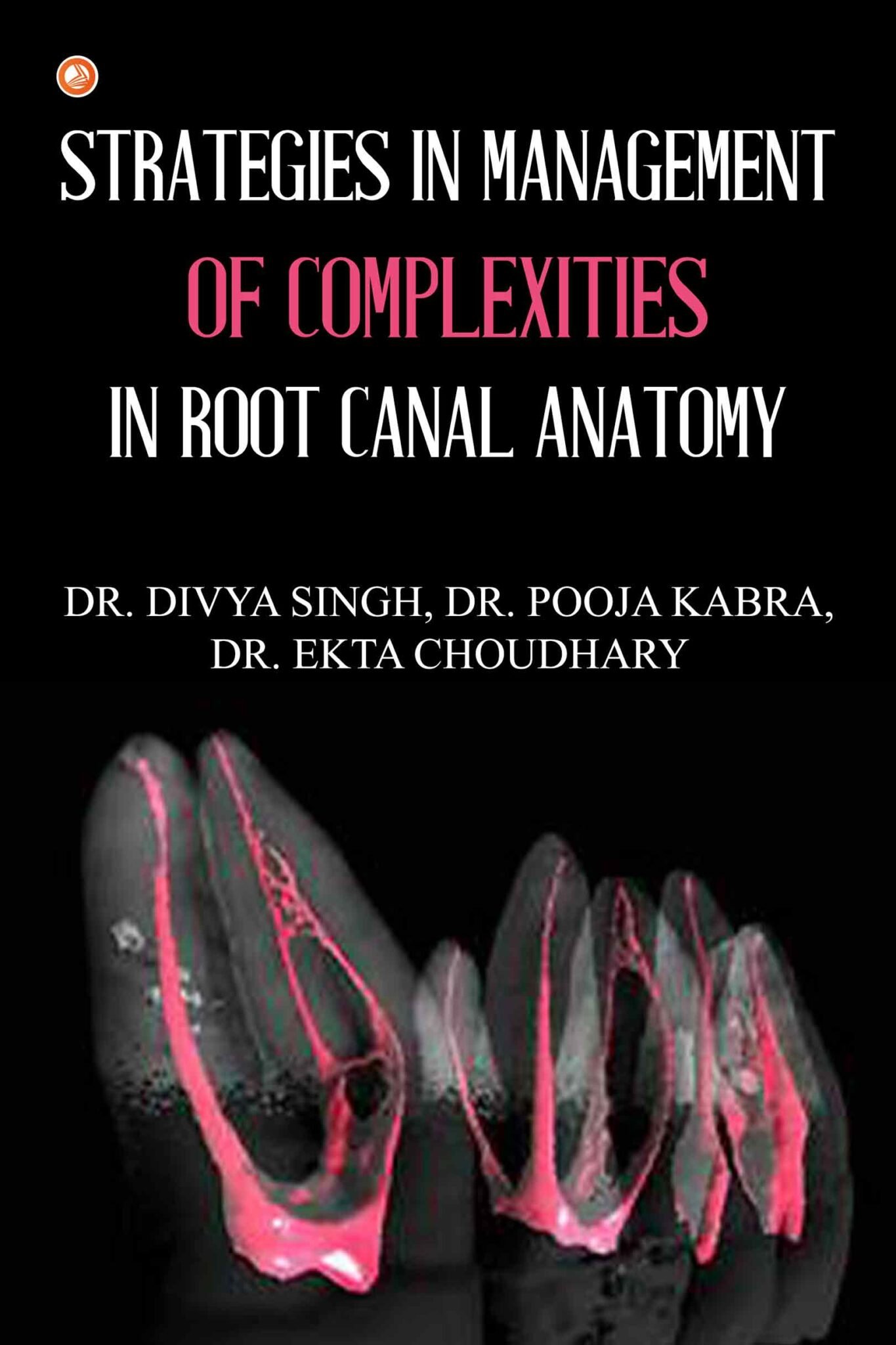 Strategies in Management of Complexities in Root Canal Anatomy | Wissen ...