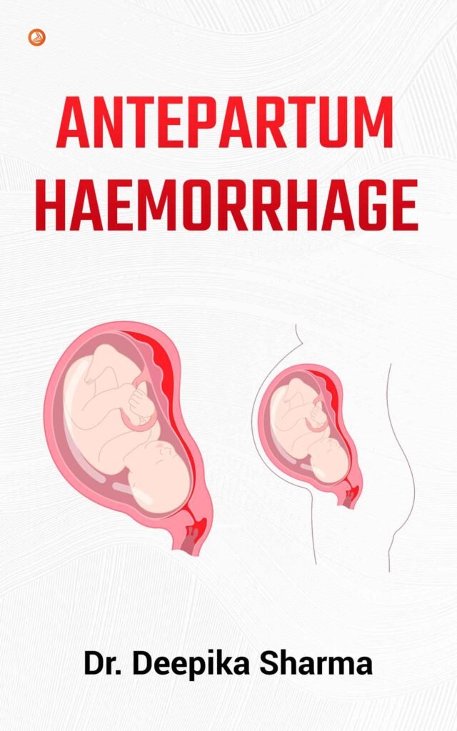 Antepartum Haemorrhage | Wissen Bookstore